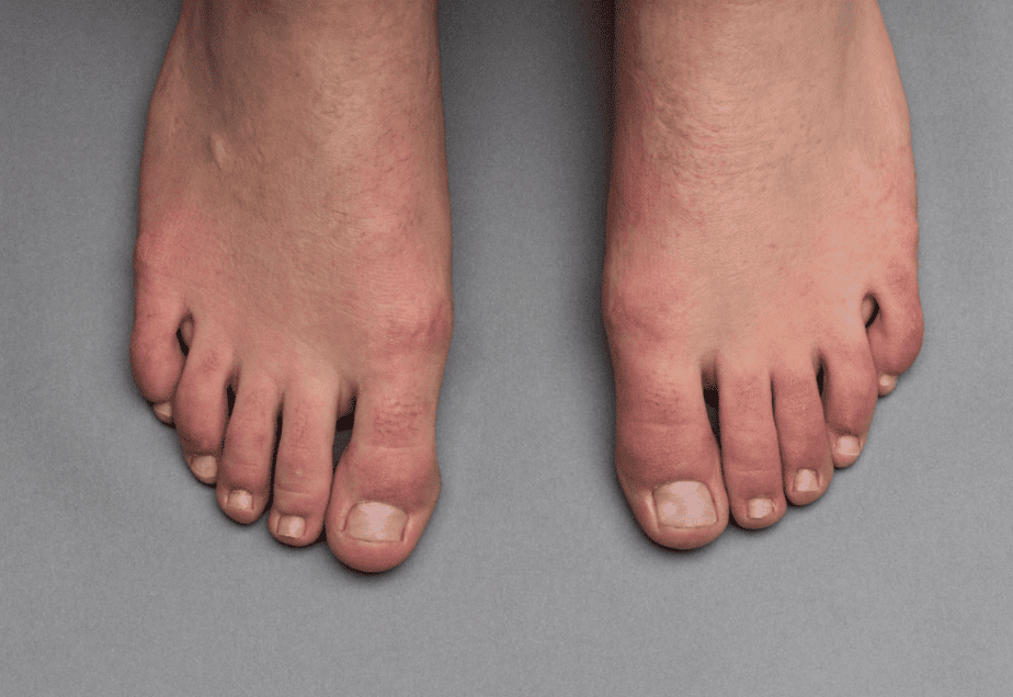 eKorinthos • Βλέπετε κάτι ασυνήθιστο σε νύχια και δέρμα; Ίσως θα πρέπει να επισκεφθείτε έναν ...